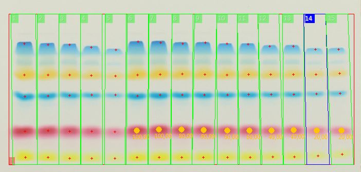 LabImage TLC - Thin Layer Chromatography - Kapelan Bio-Imaging