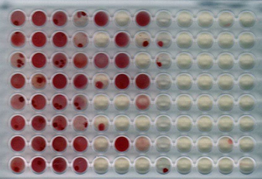 LabImage AMP - Bacterial Count Determination - Kapelan Bio-Imaging